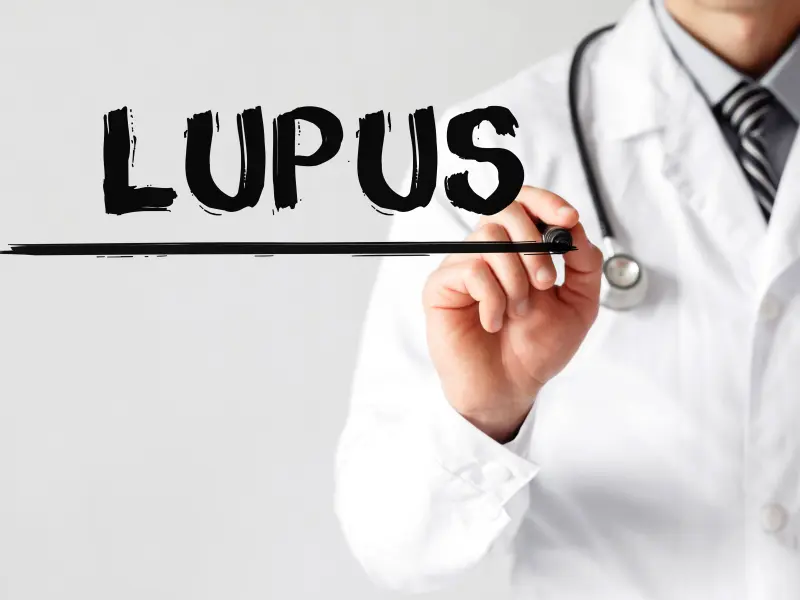 Systemic lupus erythematosus: an overview